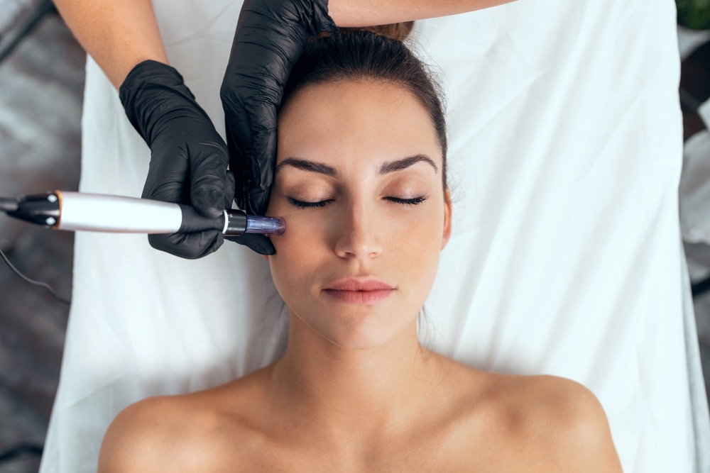 Morpheus8 RF Microneedling | RoseHall Medical Aesthetics Morpheus8 RF Microneedling | RoseHall Medical Aesthetics